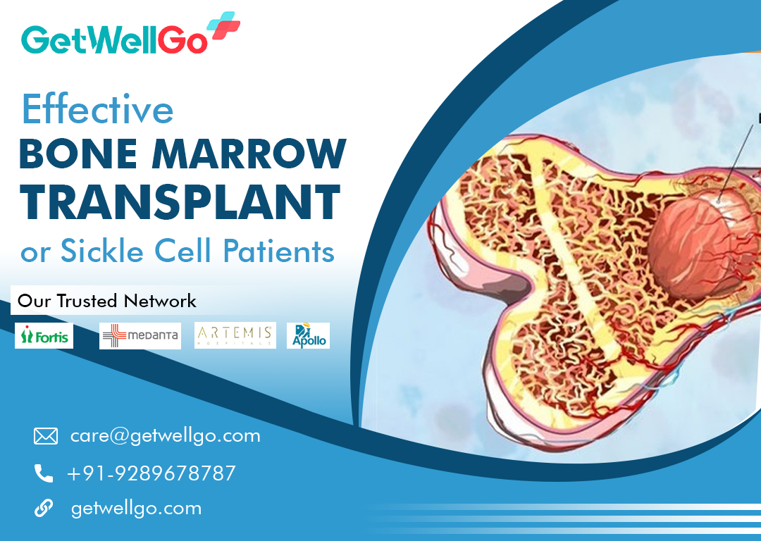 Effective Bone Marrow Transplant For Sickle Cell Patients